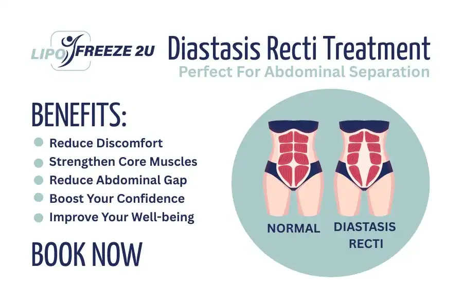 10 Benefits of Body Toning 4 Diastasis Recti Greenwich